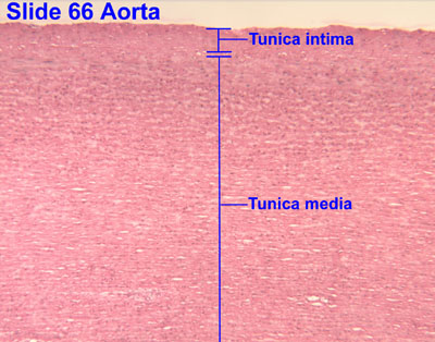 Aorta Slide Labeled